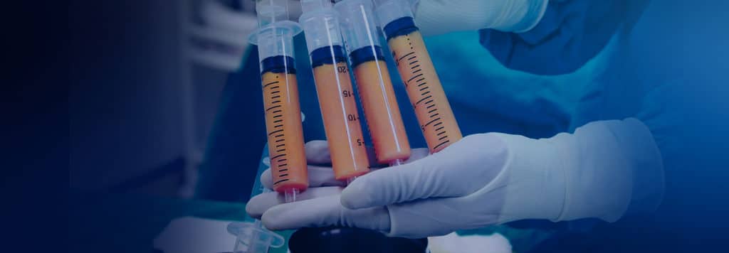 Adipose Derived Stem Cells Cost in Seattle, Kirkland & Bellevue, WA